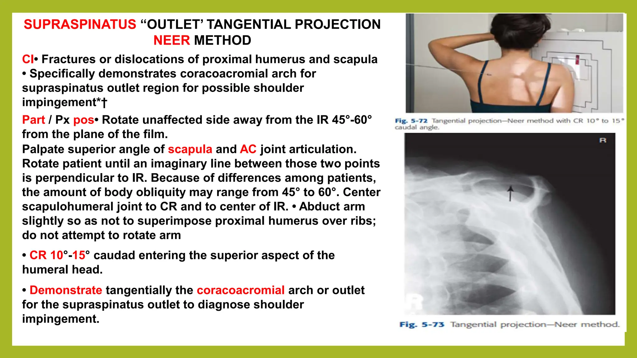 (4-M) 301 - A Shoulder to Clavicle.pptx
