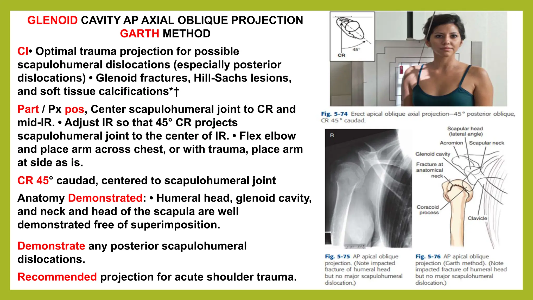 (4-M) 301 - A Shoulder to Clavicle.pptx