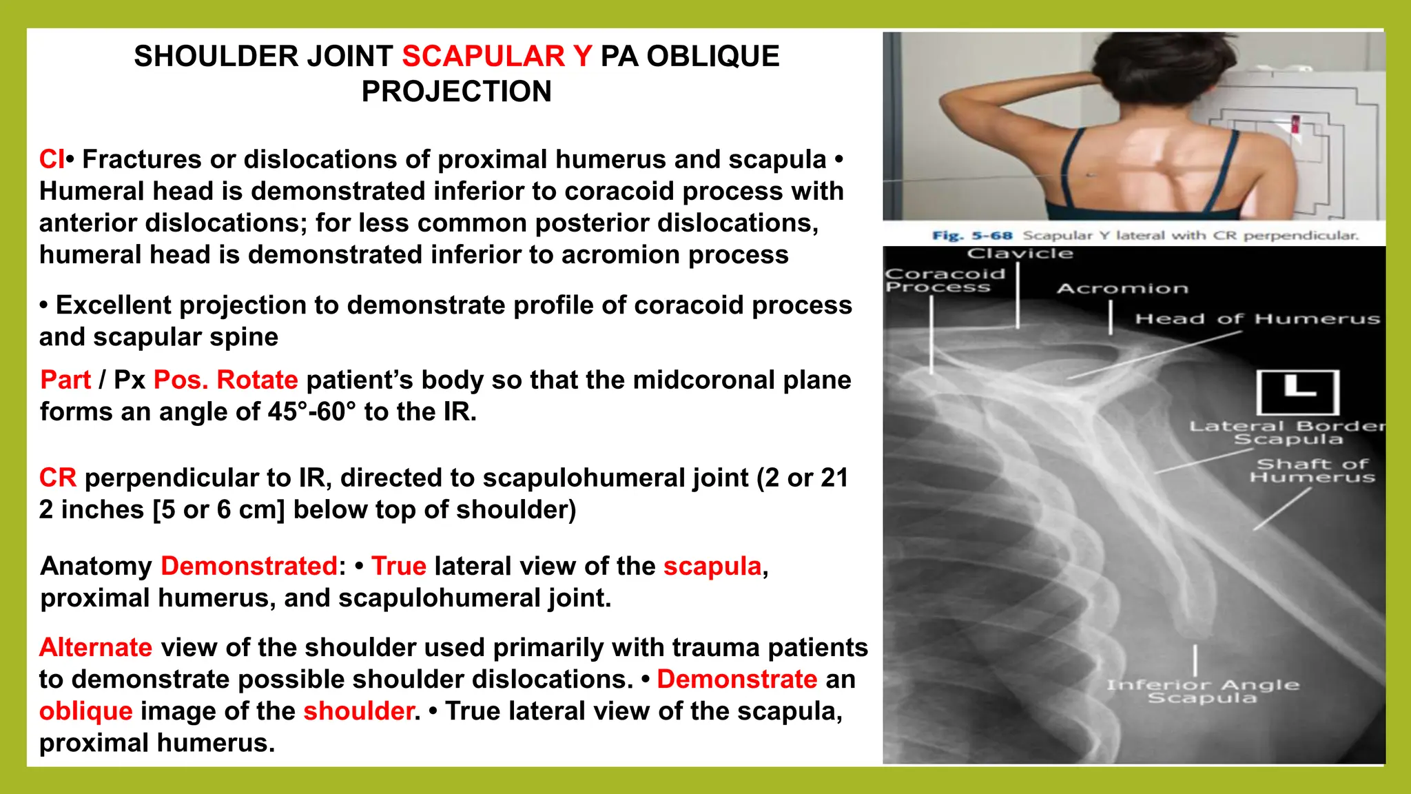 (4-M) 301 - A Shoulder to Clavicle.pptx