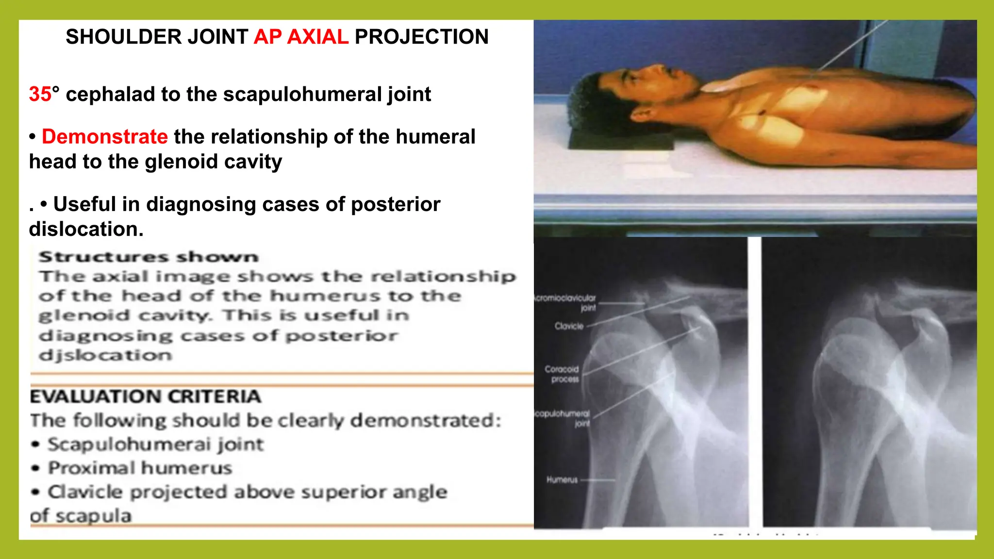 (4-M) 301 - A Shoulder to Clavicle.pptx