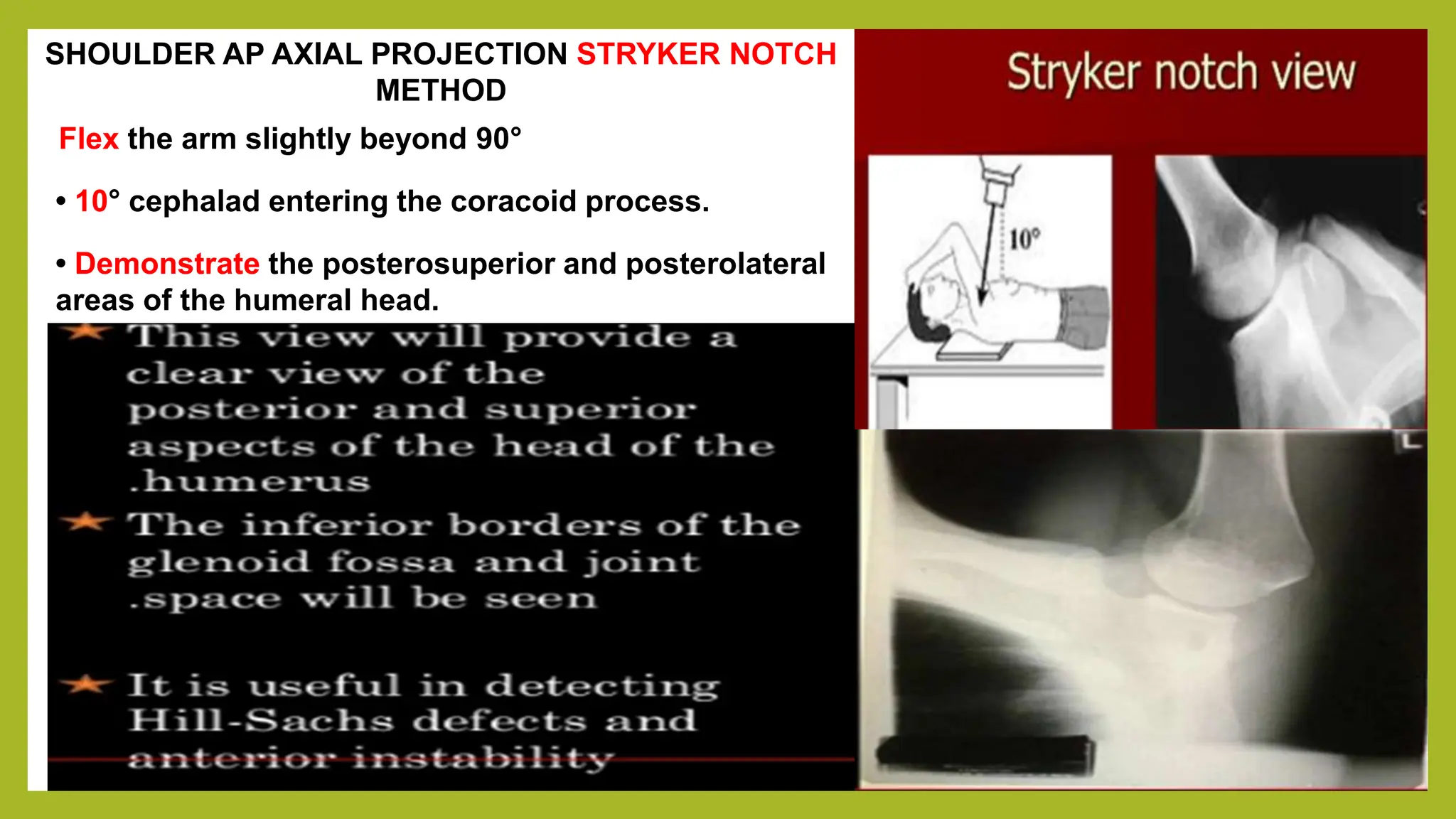 (4-M) 301 - A Shoulder to Clavicle.pptx
