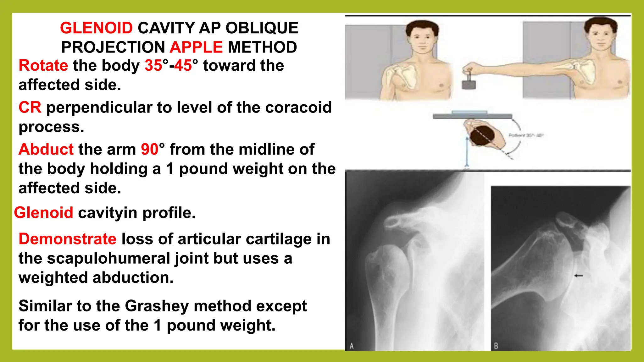 (4-M) 301 - A Shoulder to Clavicle.pptx