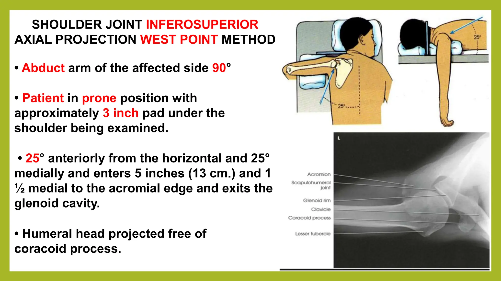 (4-M) 301 - A Shoulder to Clavicle.pptx
