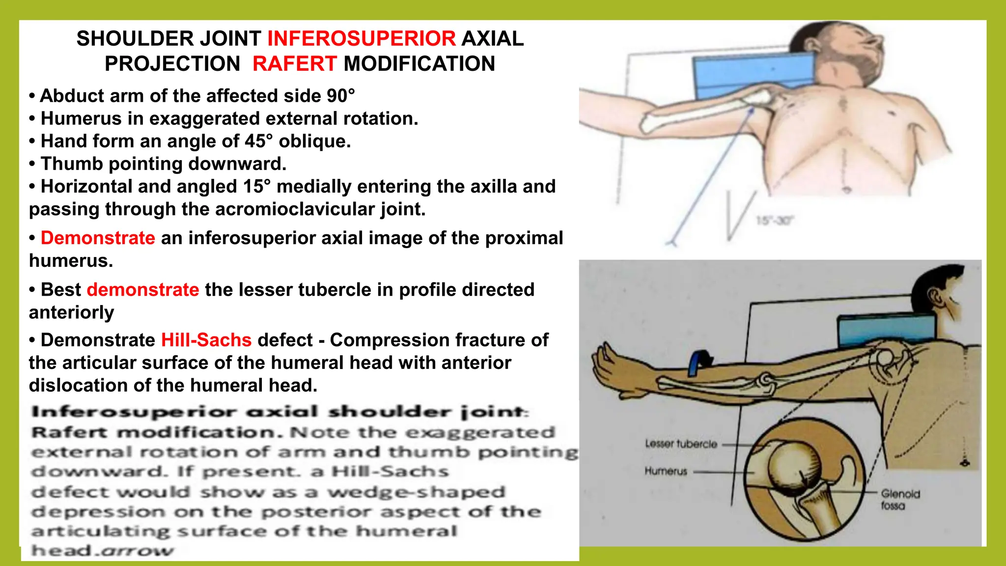 (4-M) 301 - A Shoulder to Clavicle.pptx