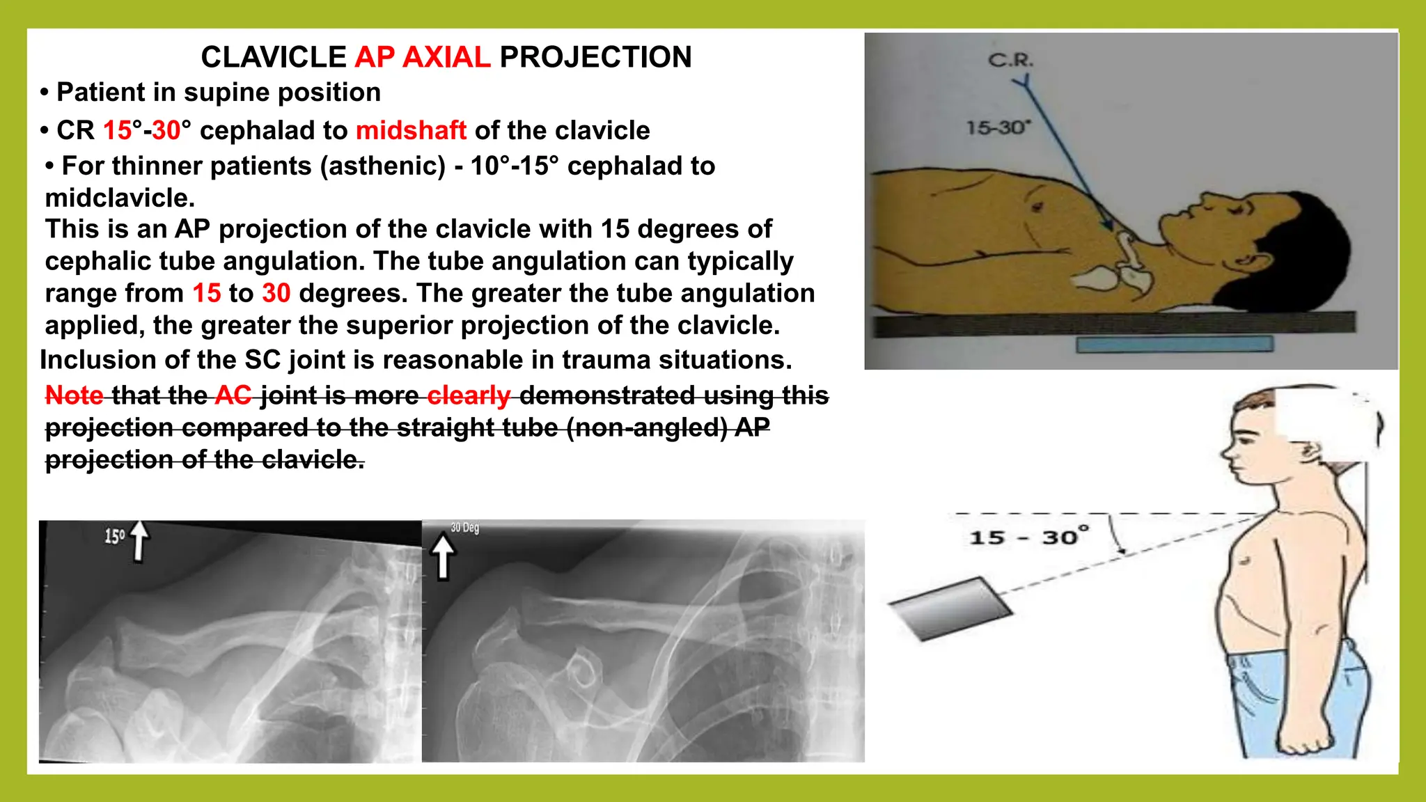 (4-M) 301 - A Shoulder to Clavicle.pptx