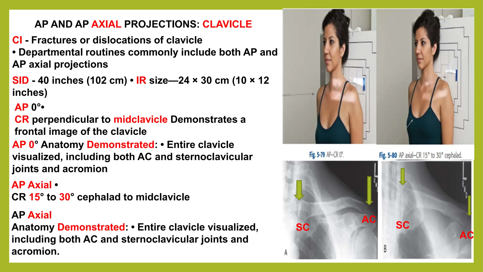 (4-M) 301 - A Shoulder to Clavicle.pptx