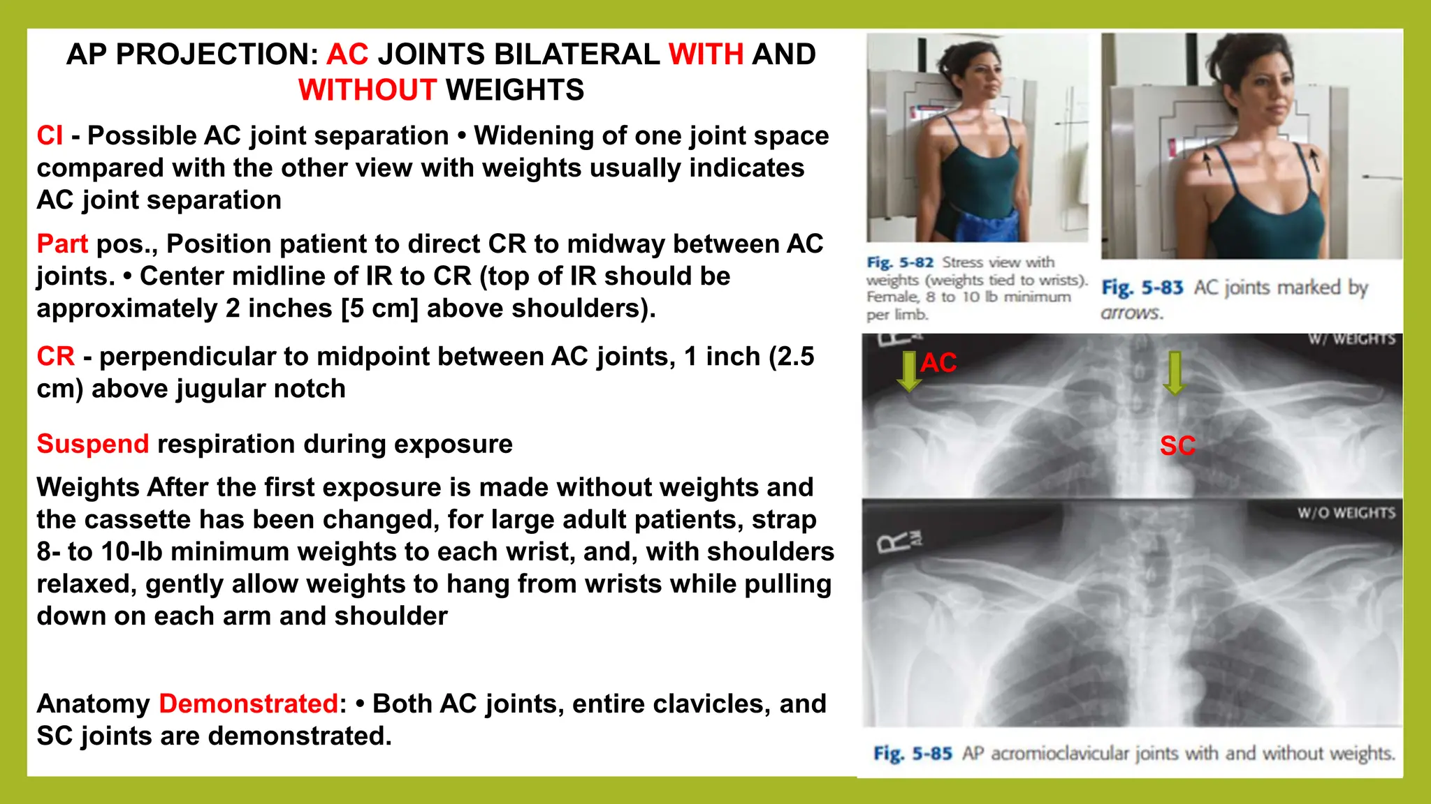 (4-M) 301 - A Shoulder to Clavicle.pptx