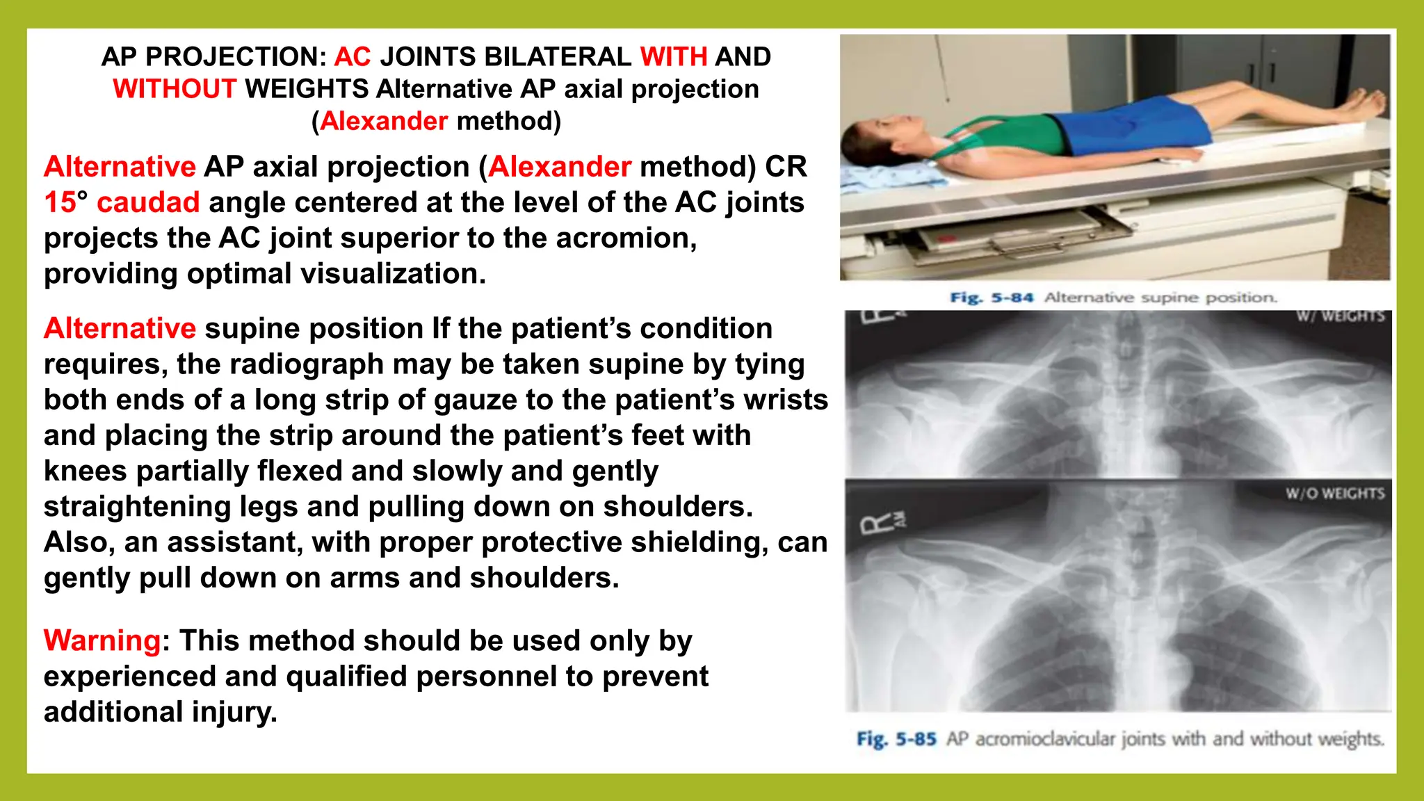 (4-M) 301 - A Shoulder to Clavicle.pptx