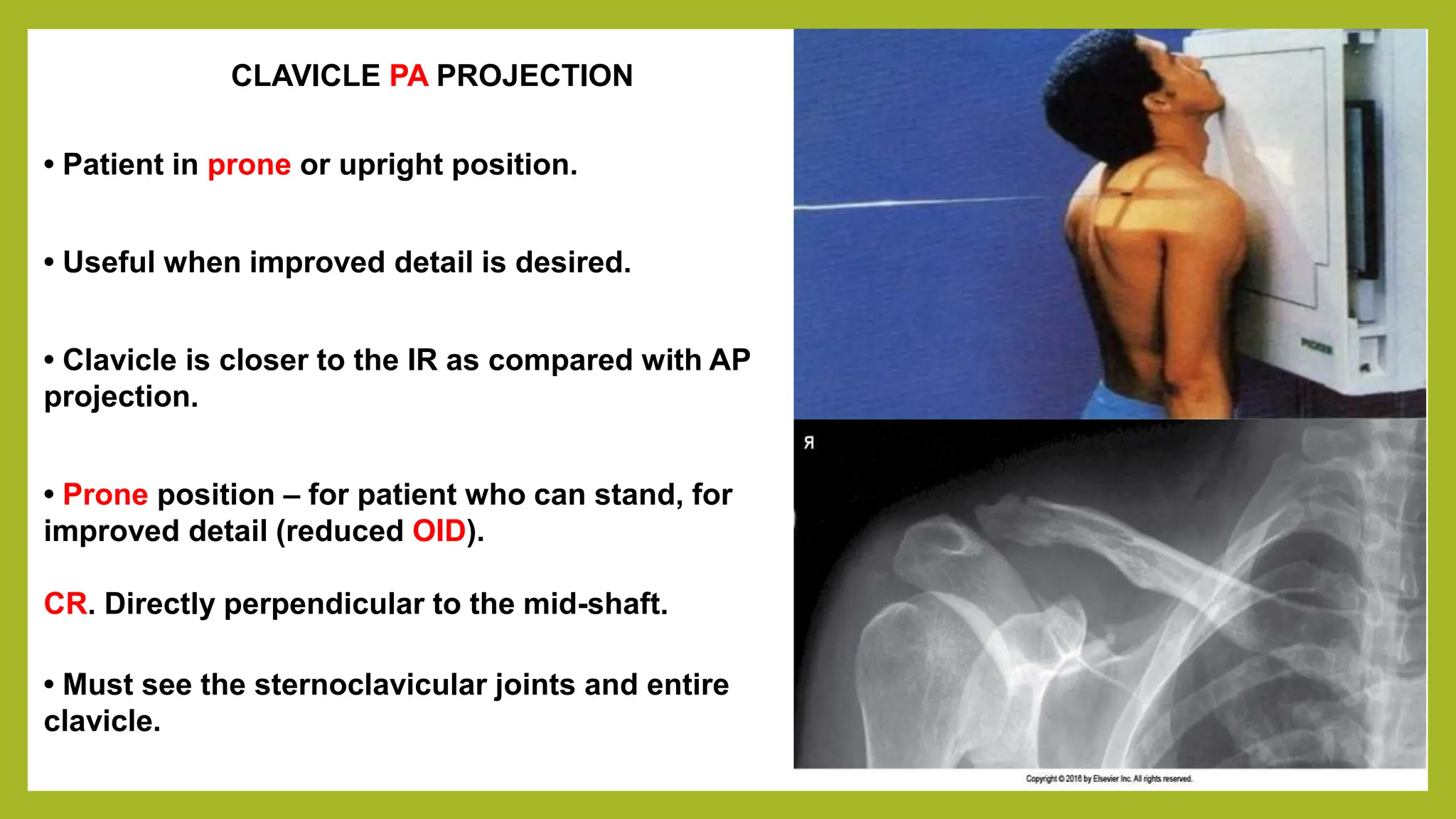 (4-M) 301 - A Shoulder to Clavicle.pptx