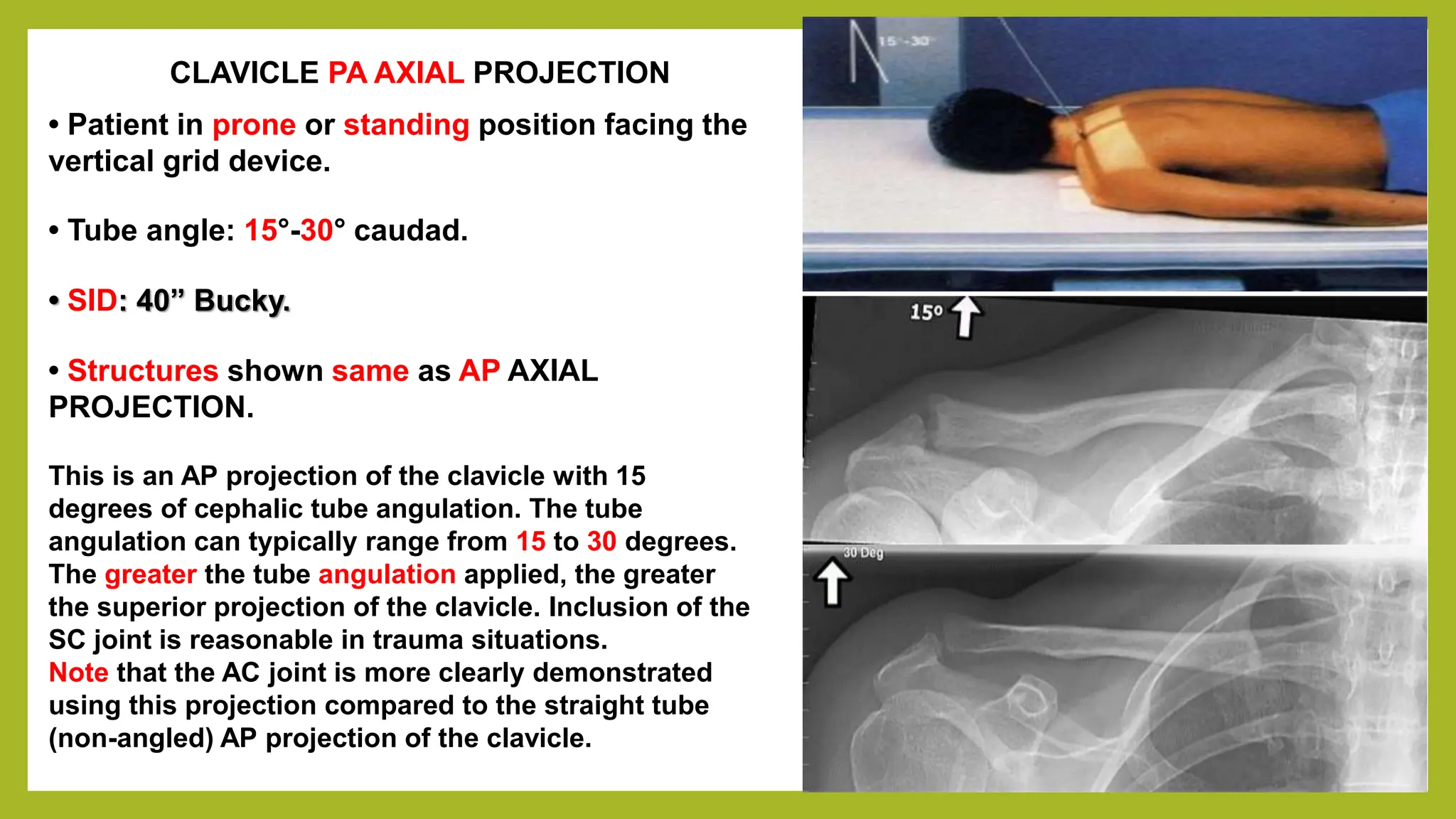(4-M) 301 - A Shoulder to Clavicle.pptx