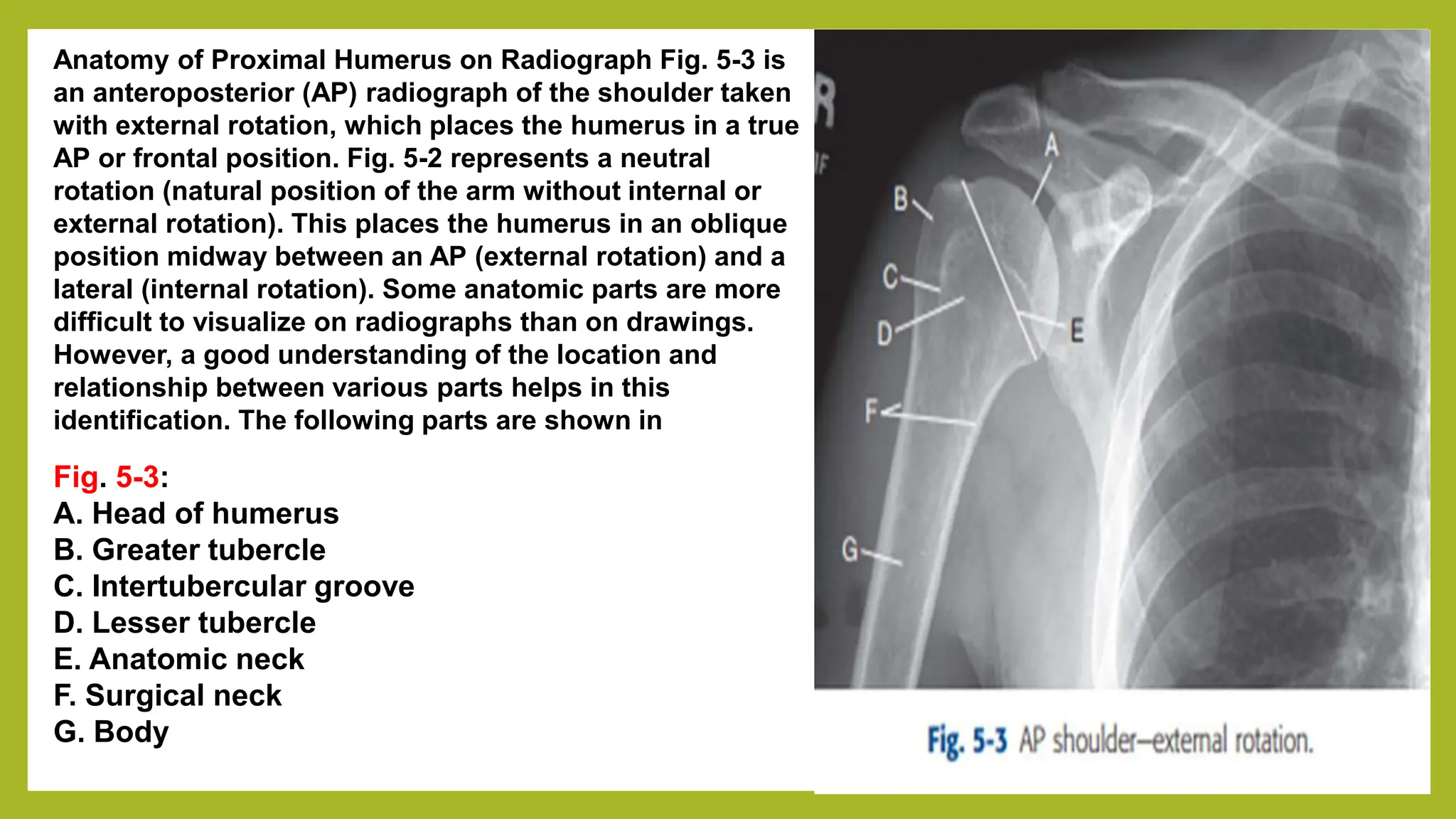 (4-M) 301 - A Shoulder to Clavicle.pptx