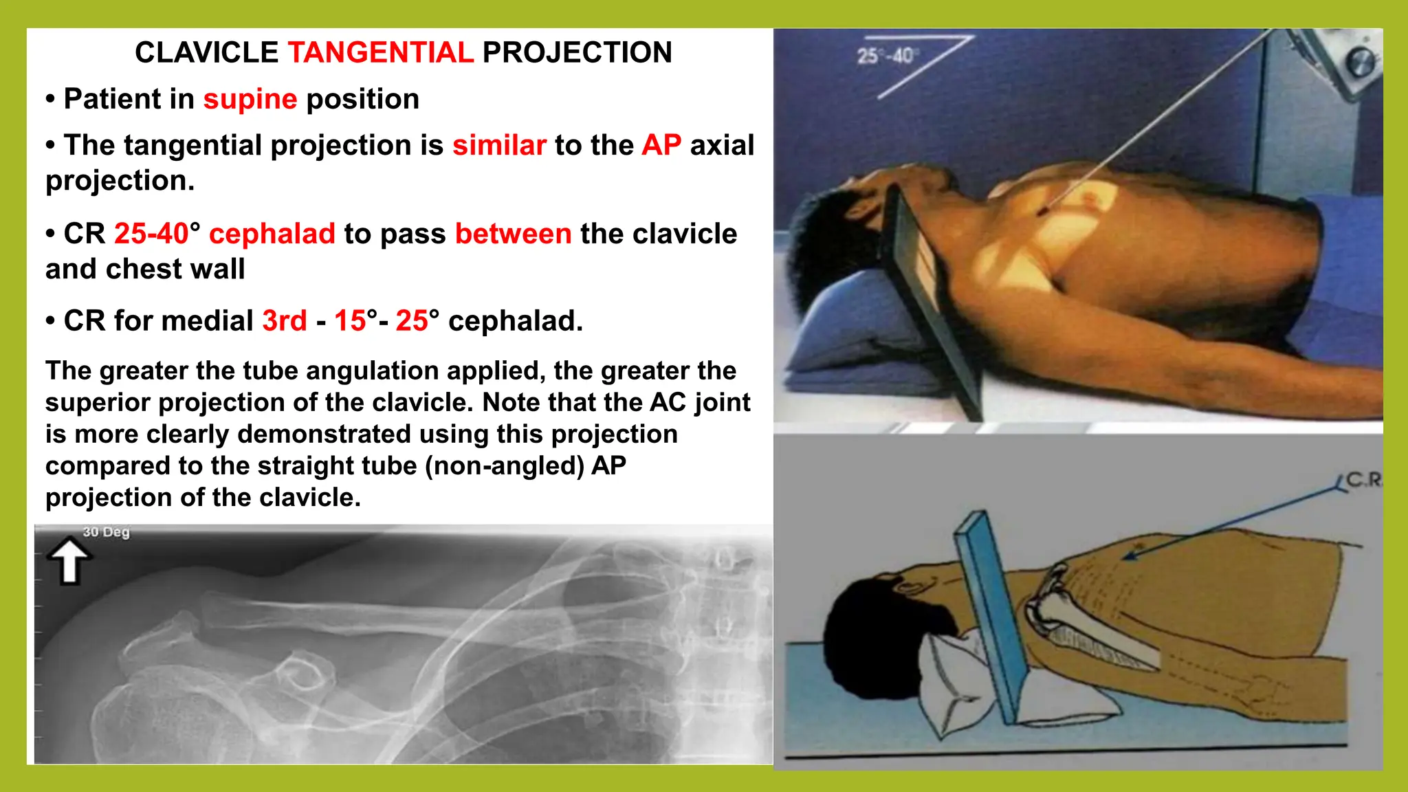 (4-M) 301 - A Shoulder to Clavicle.pptx