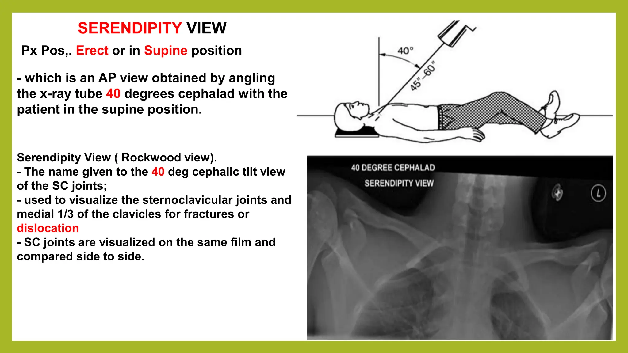 (4-M) 301 - A Shoulder to Clavicle.pptx