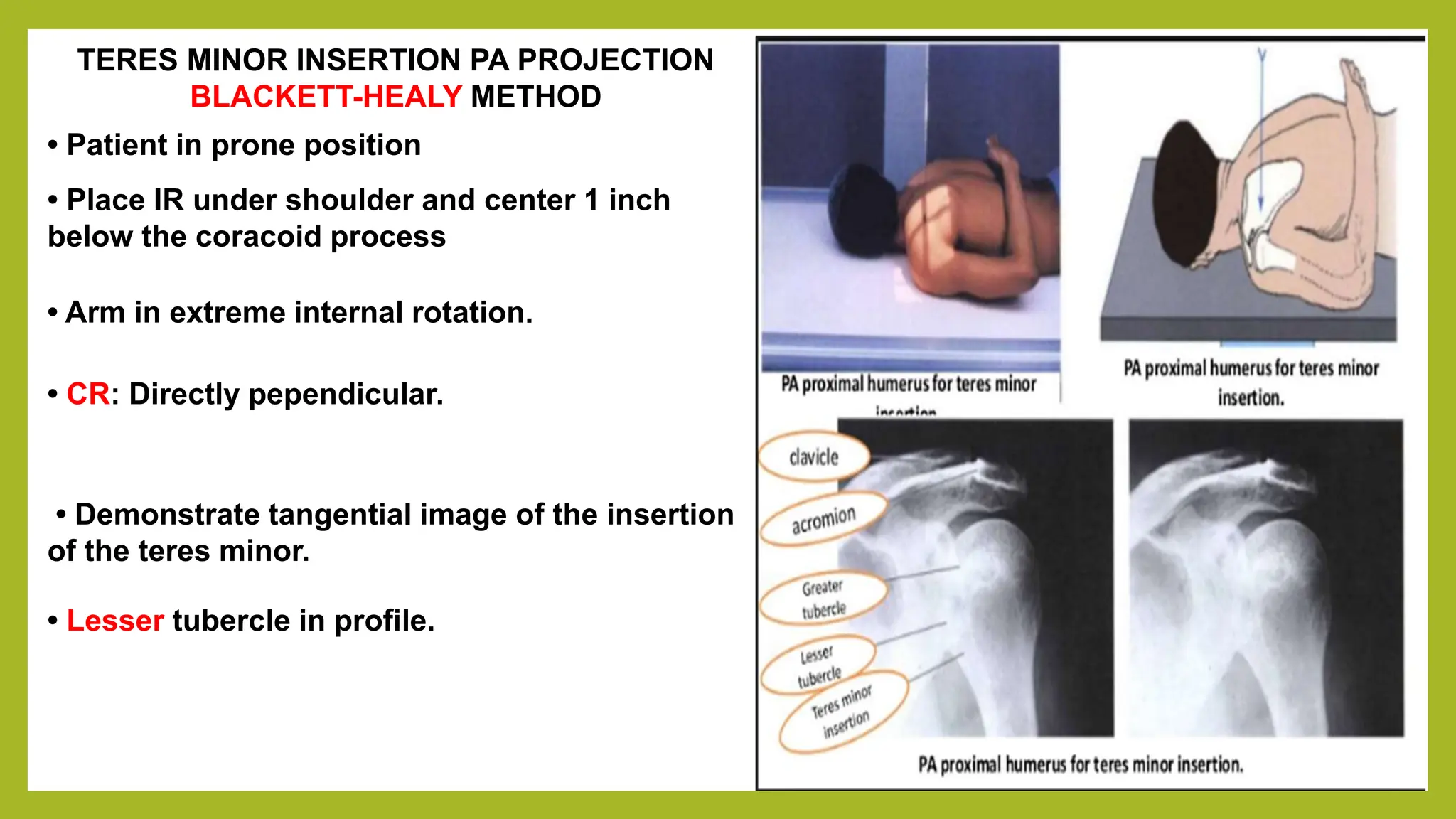 (4-M) 301 - A Shoulder to Clavicle.pptx