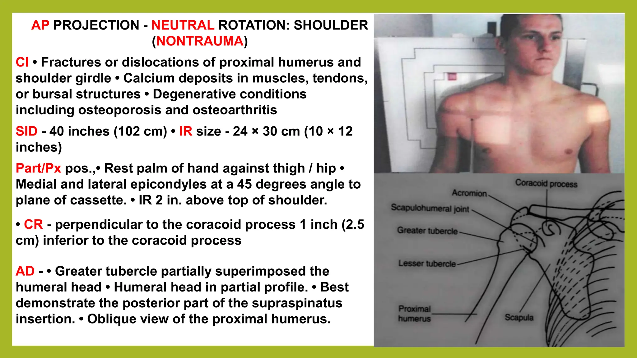 (4-M) 301 - A Shoulder to Clavicle.pptx