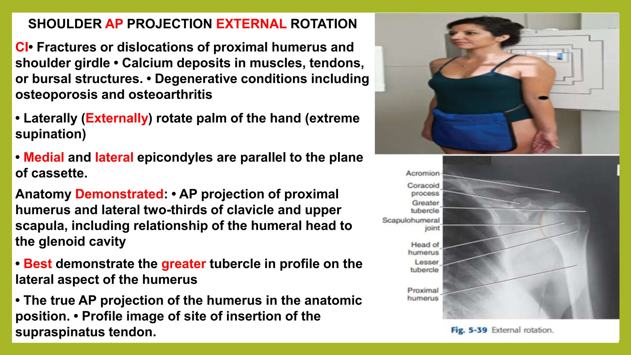 (4-M) 301 - A Shoulder to Clavicle.pptx