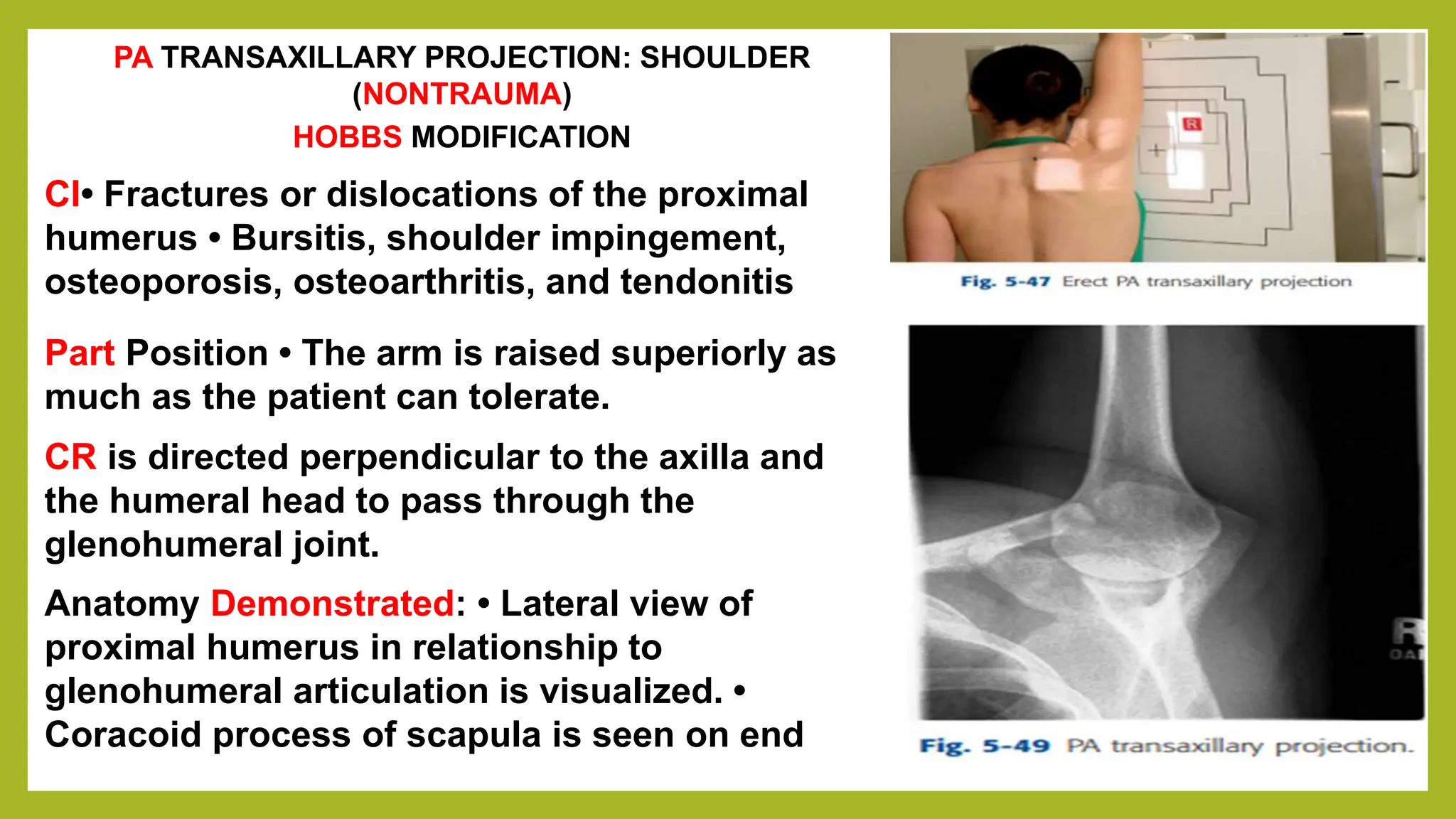 (4-M) 301 - A Shoulder to Clavicle.pptx