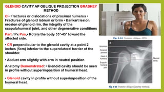 (4-M) 301 - A Shoulder to Clavicle.pptx