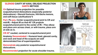 (4-M) 301 - A Shoulder to Clavicle.pptx