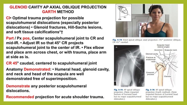 (4-M) 301 - A Shoulder to Clavicle.pptx | Death, Injury, or Military ...