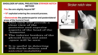 (4-M) 301 - A Shoulder to Clavicle.pptx