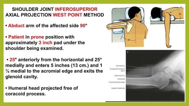 (4-M) 301 - A Shoulder to Clavicle.pptx | Death, Injury, or Military ...