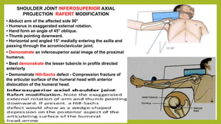 (4-M) 301 - A Shoulder to Clavicle.pptx
