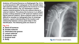 (4-M) 301 - A Shoulder to Clavicle.pptx