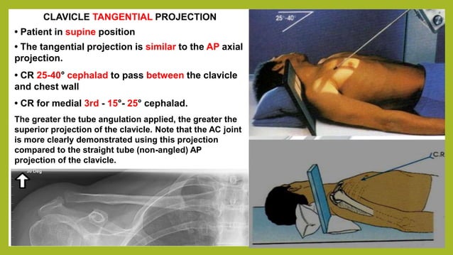 (4-M) 301 - A Shoulder to Clavicle.pptx | Death, Injury, or Military ...