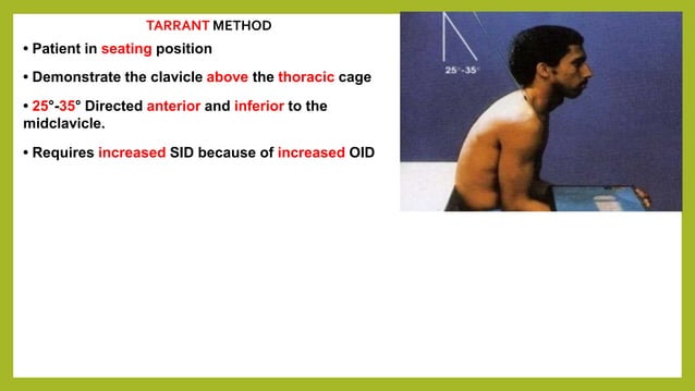 (4-M) 301 - A Shoulder to Clavicle.pptx | Death, Injury, or Military ...