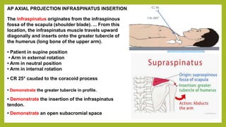 (4-M) 301 - A Shoulder to Clavicle.pptx