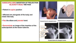 (4-M) 301 - A Shoulder to Clavicle.pptx