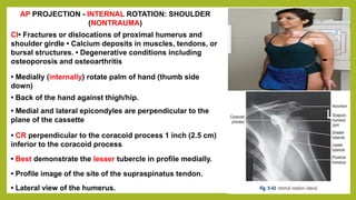 (4-M) 301 - A Shoulder to Clavicle.pptx