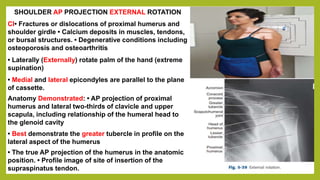 (4-M) 301 - A Shoulder to Clavicle.pptx