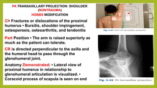 (4-M) 301 - A Shoulder to Clavicle.pptx