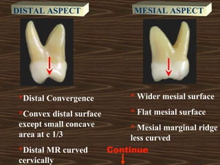 4 maxillary molars | PPT
