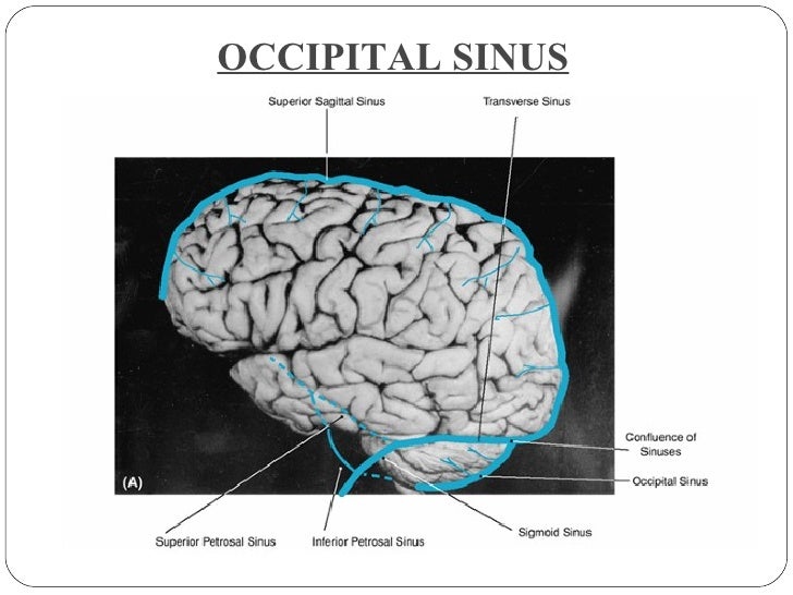 Occipital Sinus Infection