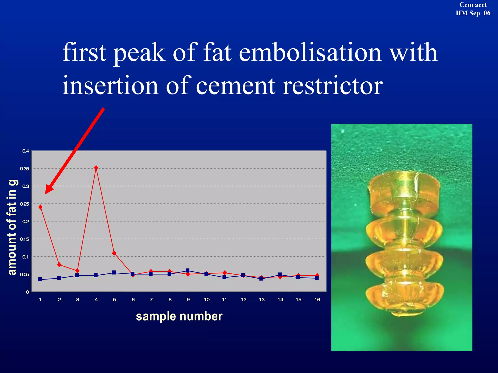 Modern Cementing Technique: Femur | PPT