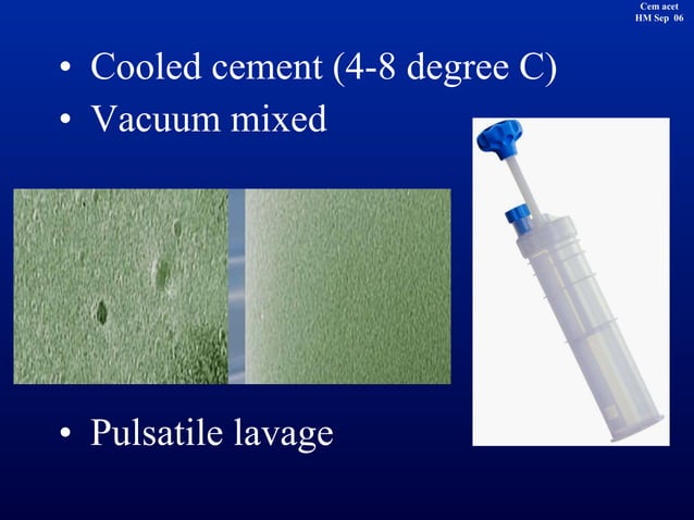 Modern Cementing Technique: Femur | PPT