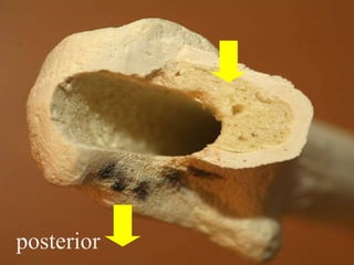 Modern Cementing Technique: Femur | PPT