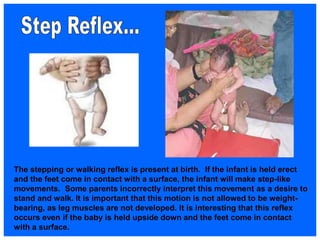 Neonatal-Evaluation-and-management ..ppt