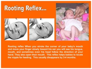 Neonatal-Evaluation-and-management ..ppt