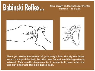 Neonatal-Evaluation-and-management ..ppt