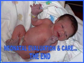Neonatal-Evaluation-and-management ..ppt