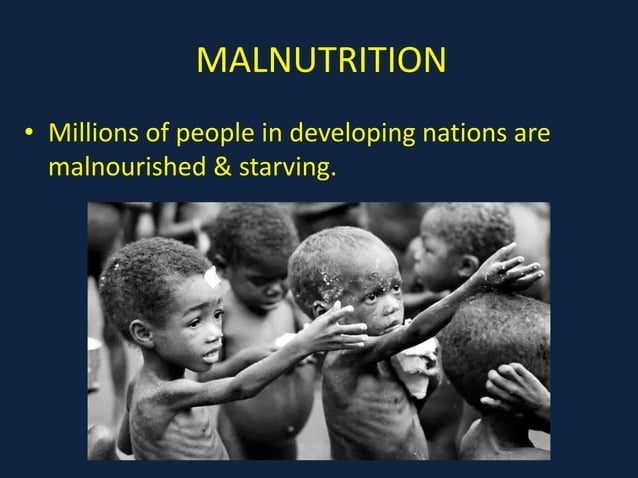 4-Nutritional-Diseases 4-Nutritional-Diseases | PPT