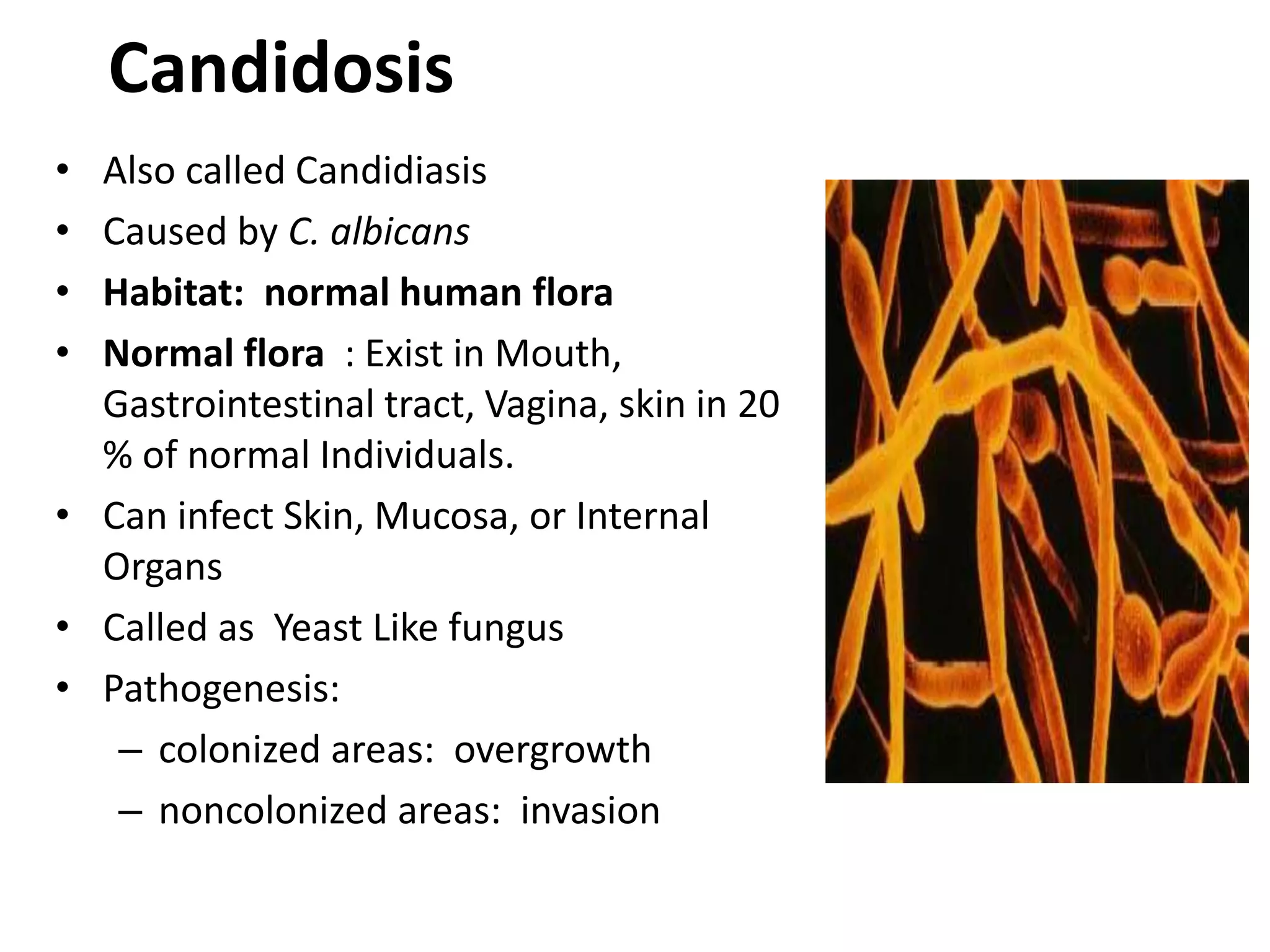 4-Opportunistic mycosis.pptx
