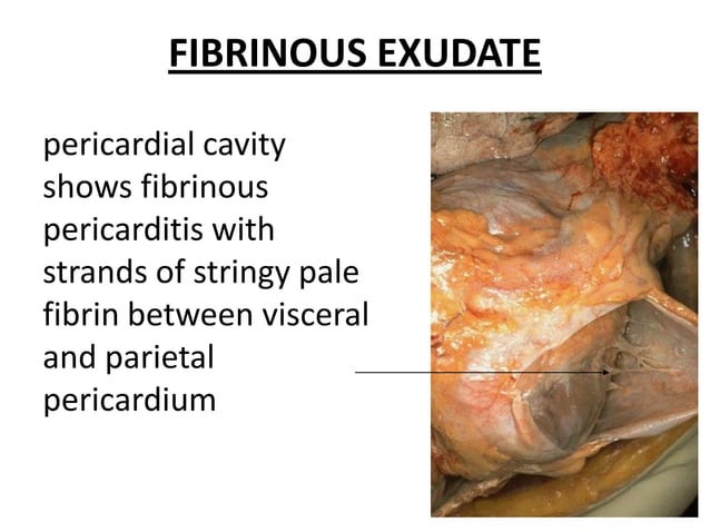 4.outcomes and morphology dr ashutosh kumar | PPT