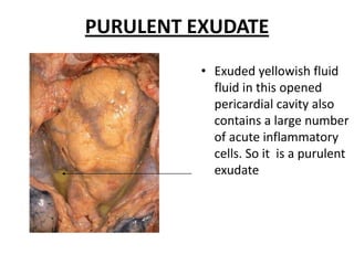 4.outcomes and morphology dr ashutosh kumar | PDF