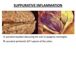 4.outcomes and morphology dr ashutosh kumar | PDF