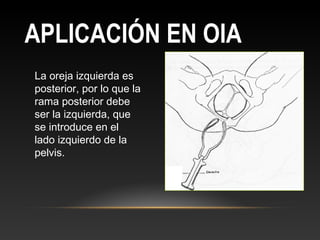 Parto con Forceps | PPT